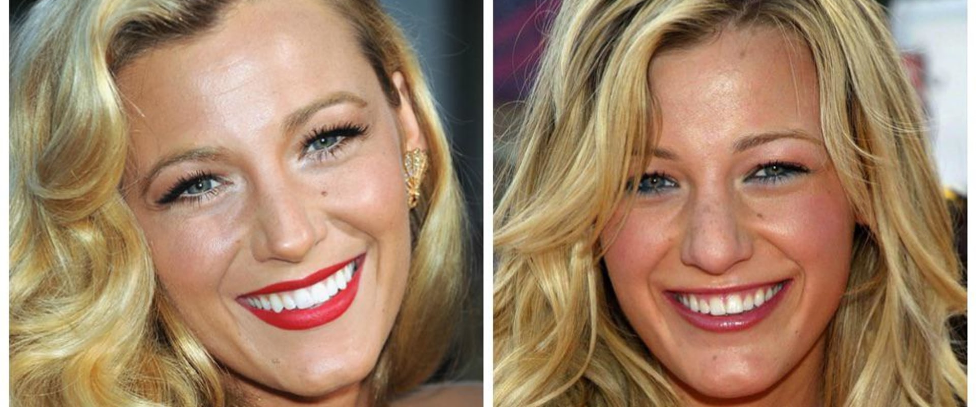 How do celebrities get nice teeth?
